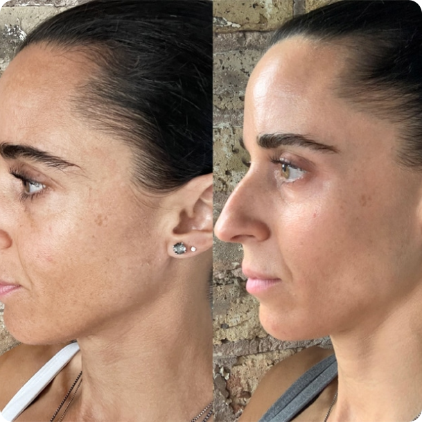 Renue Blue™ Face Cream with Methylene Blue, NAD⁺, NMN, NR (Liposomal ...